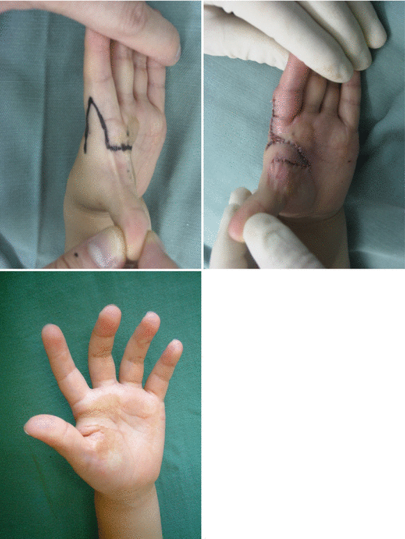 Reconstruction of First Web Space Area | SpringerLink