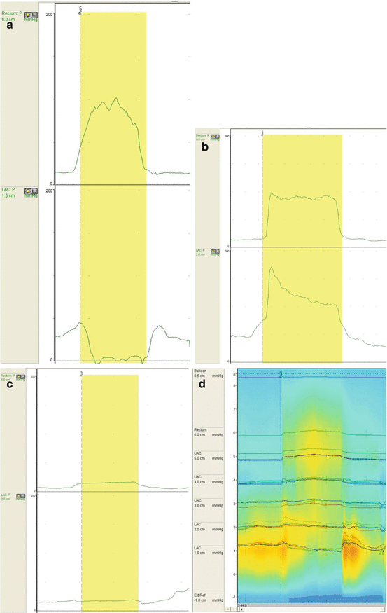 Technique, Interpretation and Clinical Application of Anorectal ...
