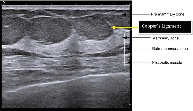 The Normal Breast | SpringerLink