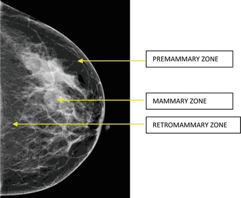 The Normal Breast | SpringerLink