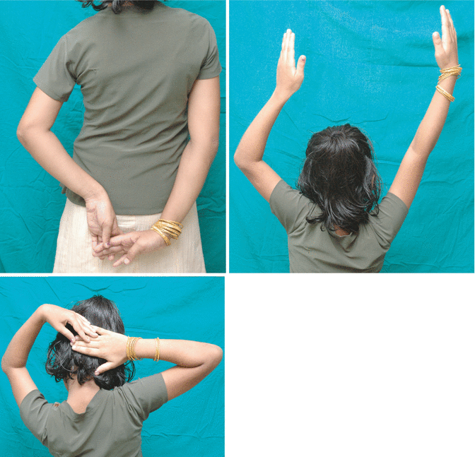 Deformities and Limitation of Movement of the Elbow | SpringerLink