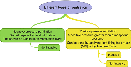 Mechanical Ventilation in Critically Ill Obstetric Patient | SpringerLink