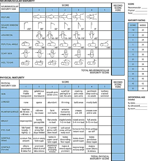 Physical Examination of the Newborn | SpringerLink