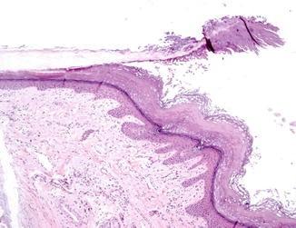 Nail Anatomy and Physiology for the Clinician | SpringerLink