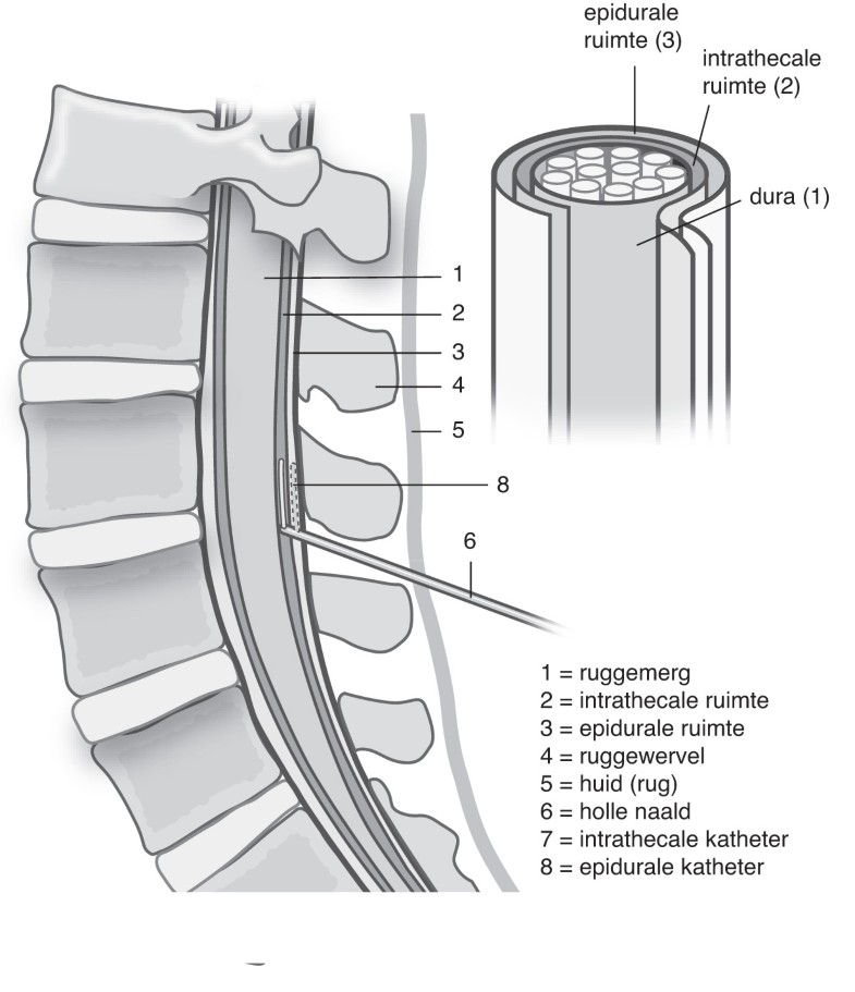 Bijzondere toedieningsvormen van opioïden | SpringerLink
