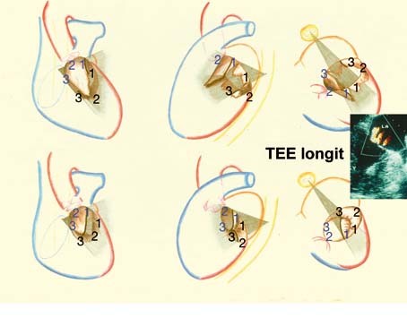 12 De mitralisklep | SpringerLink