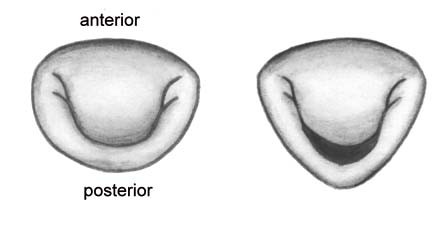 12 De mitralisklep | SpringerLink