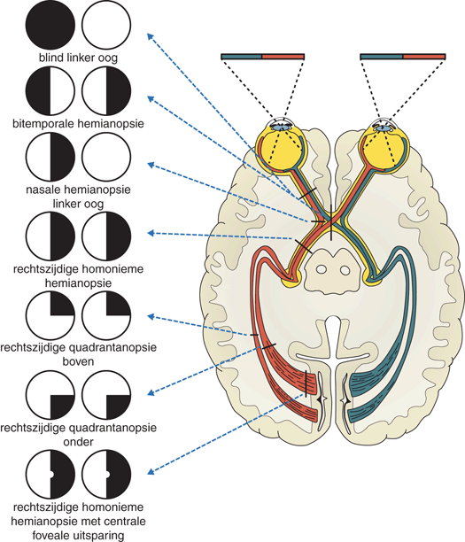 Minder vaak voorkomende aandoeningen | SpringerLink