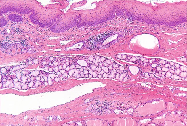 De tong | SpringerLink