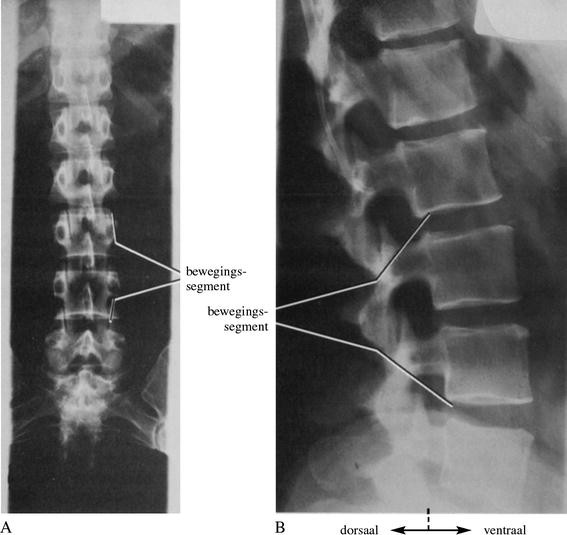 12 Biomechanica van de lumbale wervelkolom | SpringerLink