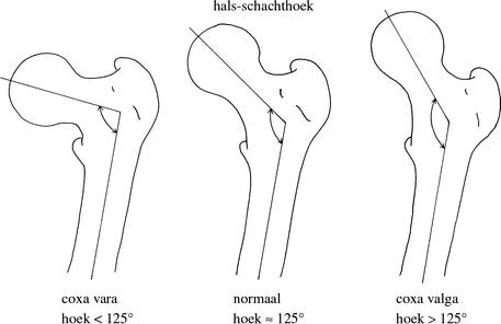 8 Biomechanica van de heup | SpringerLink