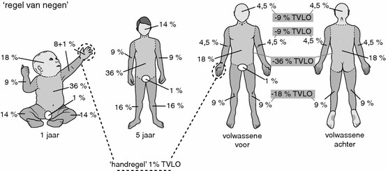 Voeding bij brandwonden | SpringerLink