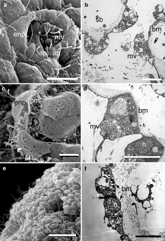 Development of Homoscleromorpha of the Order Homosclerophorida Dendy ...
