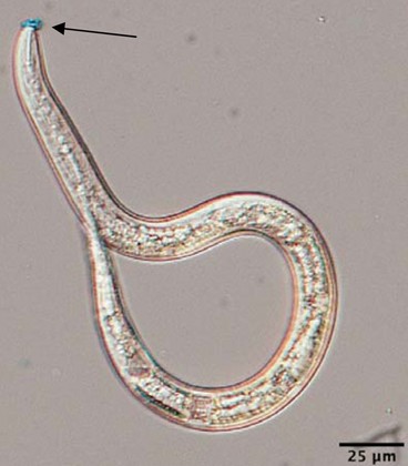 Root-knot Nematodes and Giant Cells | SpringerLink