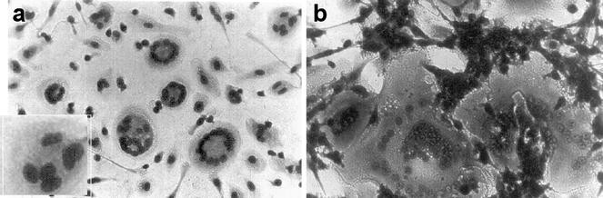 Macrophage Fusion and Multinucleated Giant Cells of Inflammation ...