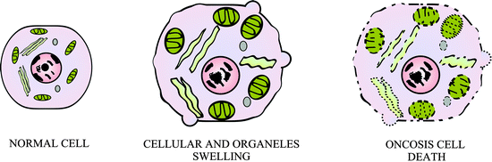 Oncosis | SpringerLink