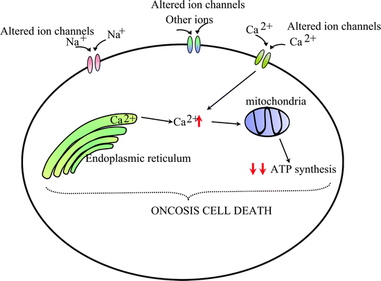 Oncosis | SpringerLink