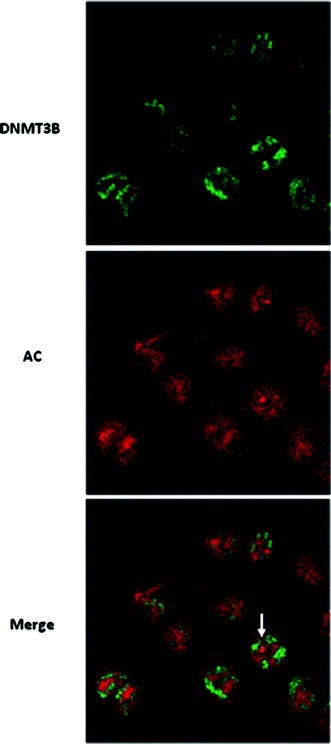 Anthocyanins and Cancer Prevention | SpringerLink