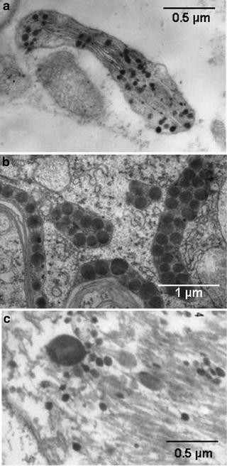 Plastoglobuli, Thylakoids, Chloroplast Structure and Development of ...