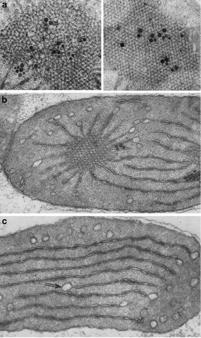 Plastoglobuli, Thylakoids, Chloroplast Structure and Development of ...