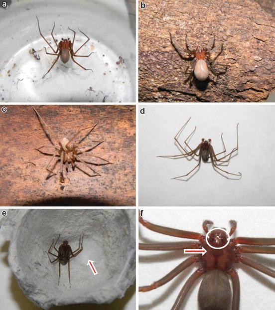 Loxosceles and Loxoscelism: Biology, Venom, Envenomation and Treatment ...
