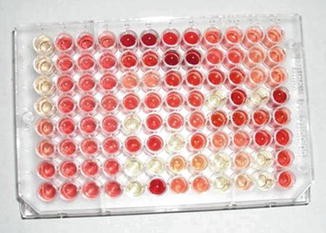 The Actual Role of LDH as Tumor Marker, Biochemical and Clinical ...