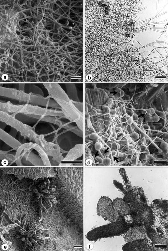 Bioerosion and Coral Reef Growth: A Dynamic Balance | SpringerLink