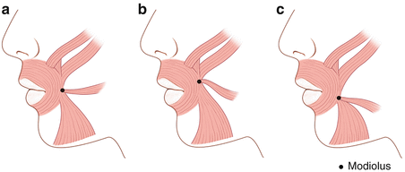Clinical Anatomy for Botulinum Toxin Injection | SpringerLink