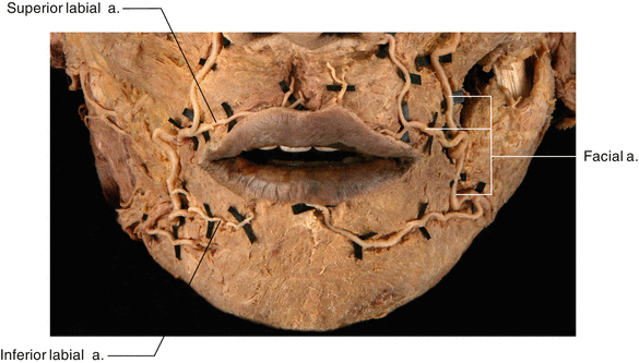 Clinical Anatomy of the Lower Face for Filler Injection | SpringerLink