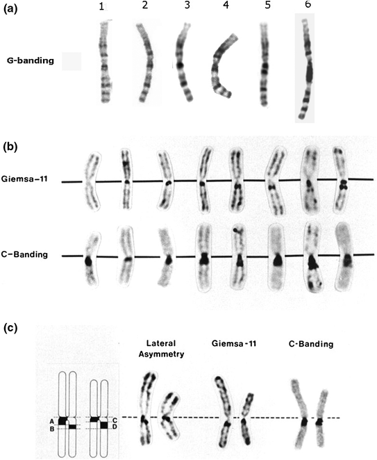 Chromosome Heteromorphism (Summaries) | SpringerLink
