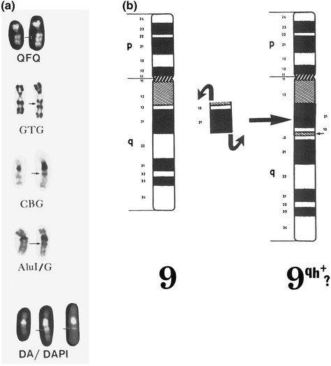 Chromosome Heteromorphism (Summaries) | SpringerLink