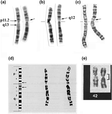 Chromosome Heteromorphism (Summaries) | SpringerLink