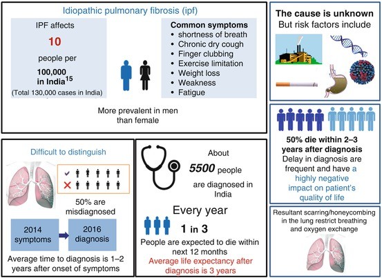 Idiopathic Pulmonary Fibrosis: Stem Cell-Mediated Therapeutic Approach ...