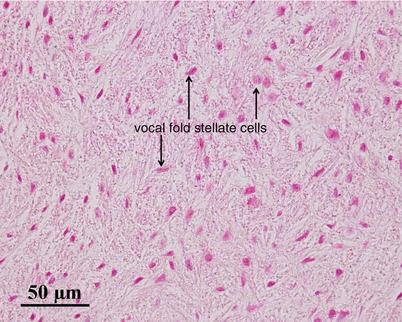 Macula Flava and Vocal Fold Stellate Cells of the Human Adult Vocal ...