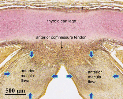 Macula Flava of the Human Newborn Vocal Fold | SpringerLink