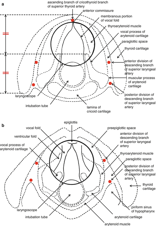 Clinical Anatomy of the Human Larynx | SpringerLink
