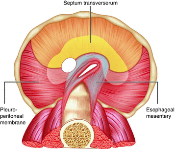 Congenital Diaphragmatic Hernia and Eventration | SpringerLink