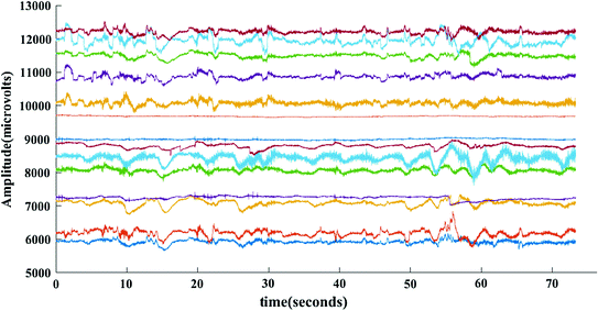 Drowsiness Detection for Safe Driving Using PCA EEG Signals | SpringerLink