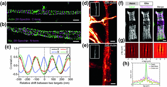 Super-Resolution STED and STORM/PALM Microscopy for Brain Imaging ...