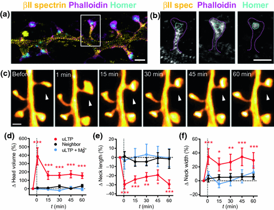 Super-Resolution STED and STORM/PALM Microscopy for Brain Imaging ...