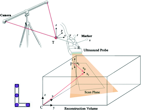 Position Tracking Systems for Ultrasound Imaging: A Survey | SpringerLink