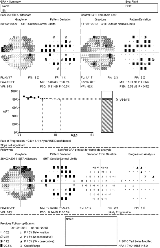 The Visual Field | SpringerLink