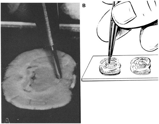 Microdissection of Individual Brain Nuclei and Areas | SpringerLink