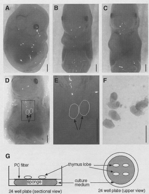 Development of T-Lymphocytes in Mouse Fetal Thymus Organ Culture ...