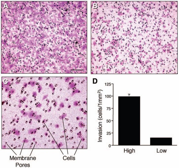 Tumor Cell Invasion Assays | SpringerLink