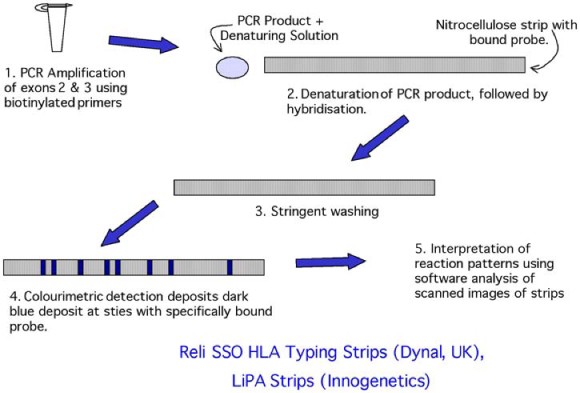 HLA Typing and Its Influence on Organ Transplantation | SpringerLink
