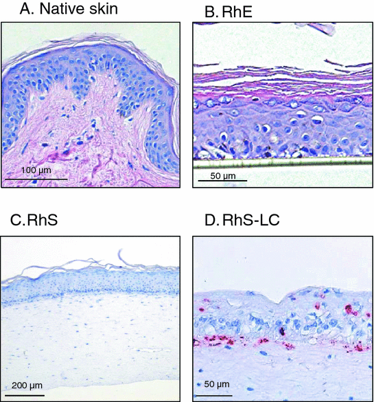 Progress on Reconstructed Human Skin Models for Allergy Research and ...