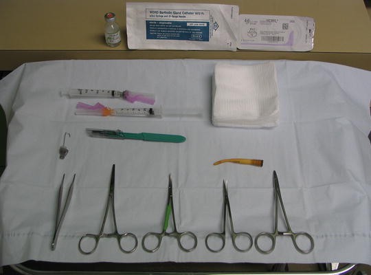 Bartholin Gland Cysts and Abscesses | SpringerLink