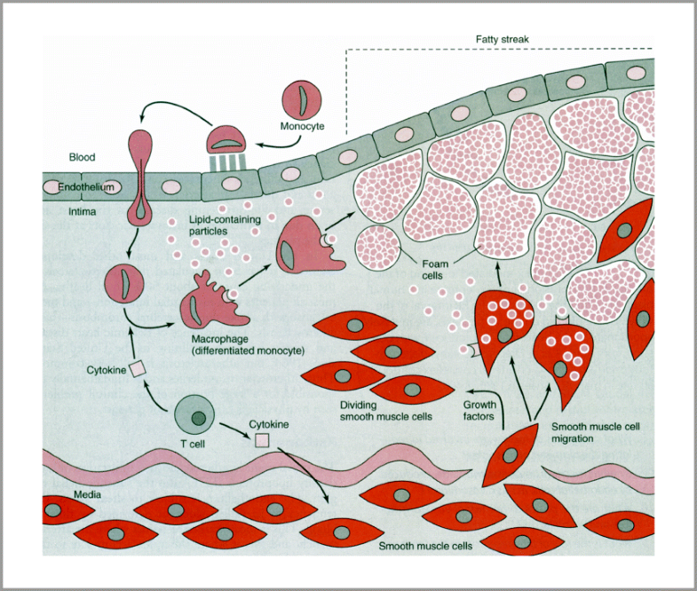 Acute Coronary Syndromes | SpringerLink