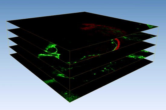 3D Reconstruction of Confocal Image Data | SpringerLink